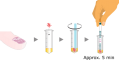 Introducing “Diafactory” (Real Time ”Fungal Nail Testing”) - The Foot ...